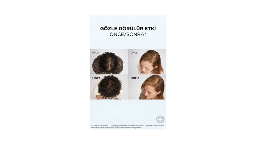 Elseve Growth Booster Dökülme Karşıtı Saç Bakım Şampuanı 200 ml ...